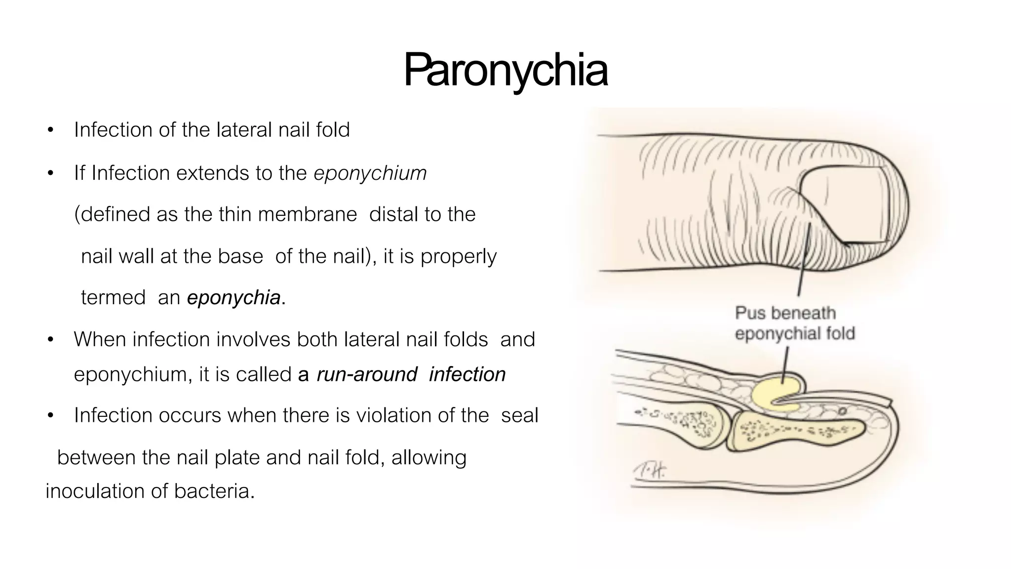 Hand infections | PDF