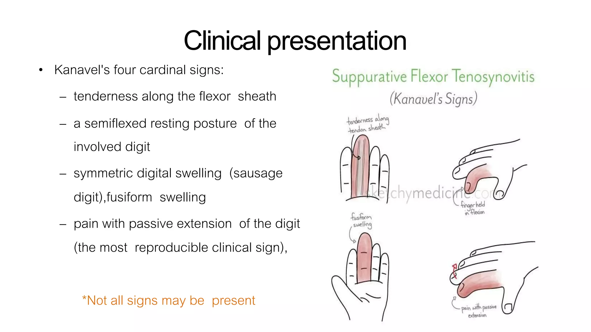 Hand infections | PDF