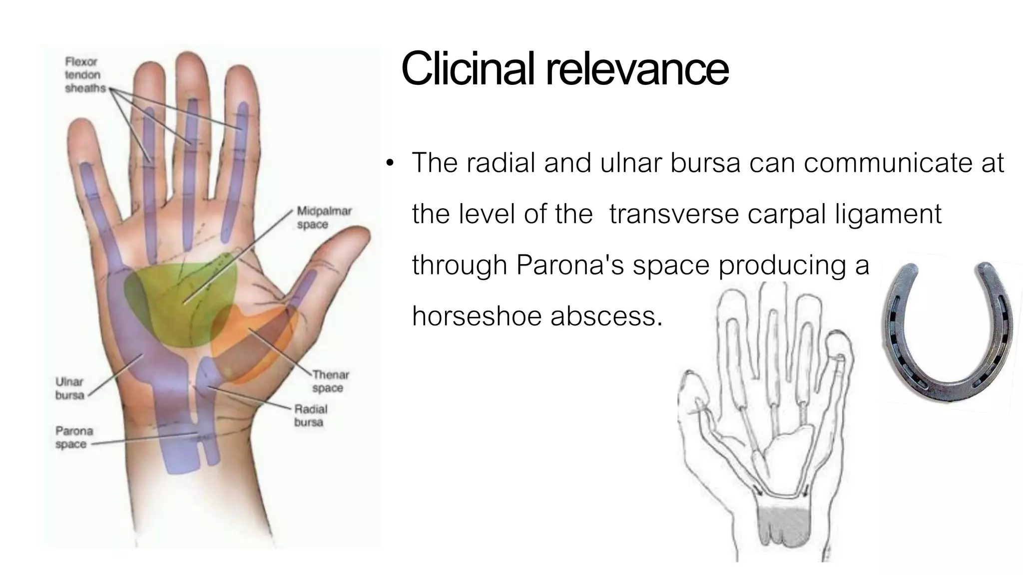 Hand infections | PDF