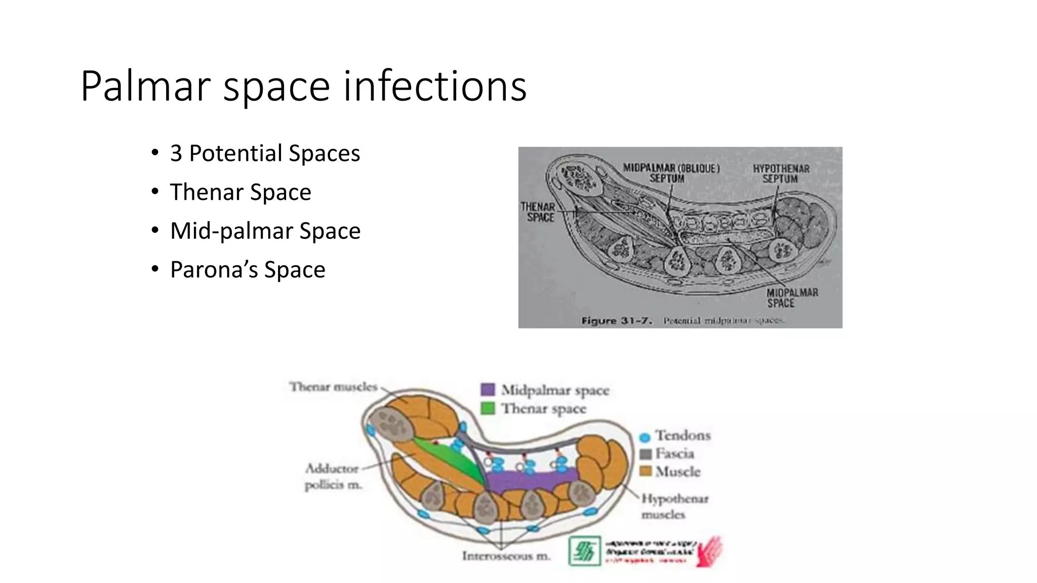 Hand Infections3.pptx