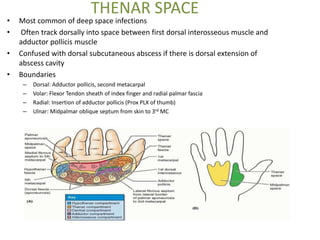 Acute Hand infections | PPTX