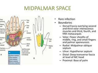 Acute Hand infections | PPTX