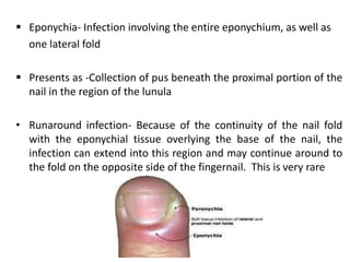 Acute Hand infections | PPT