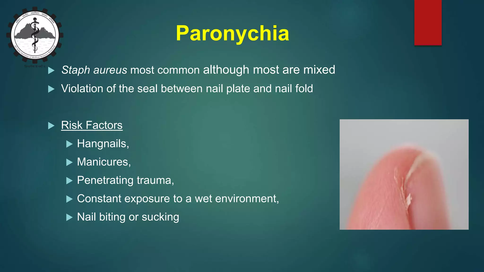 Hand infections | PPTX