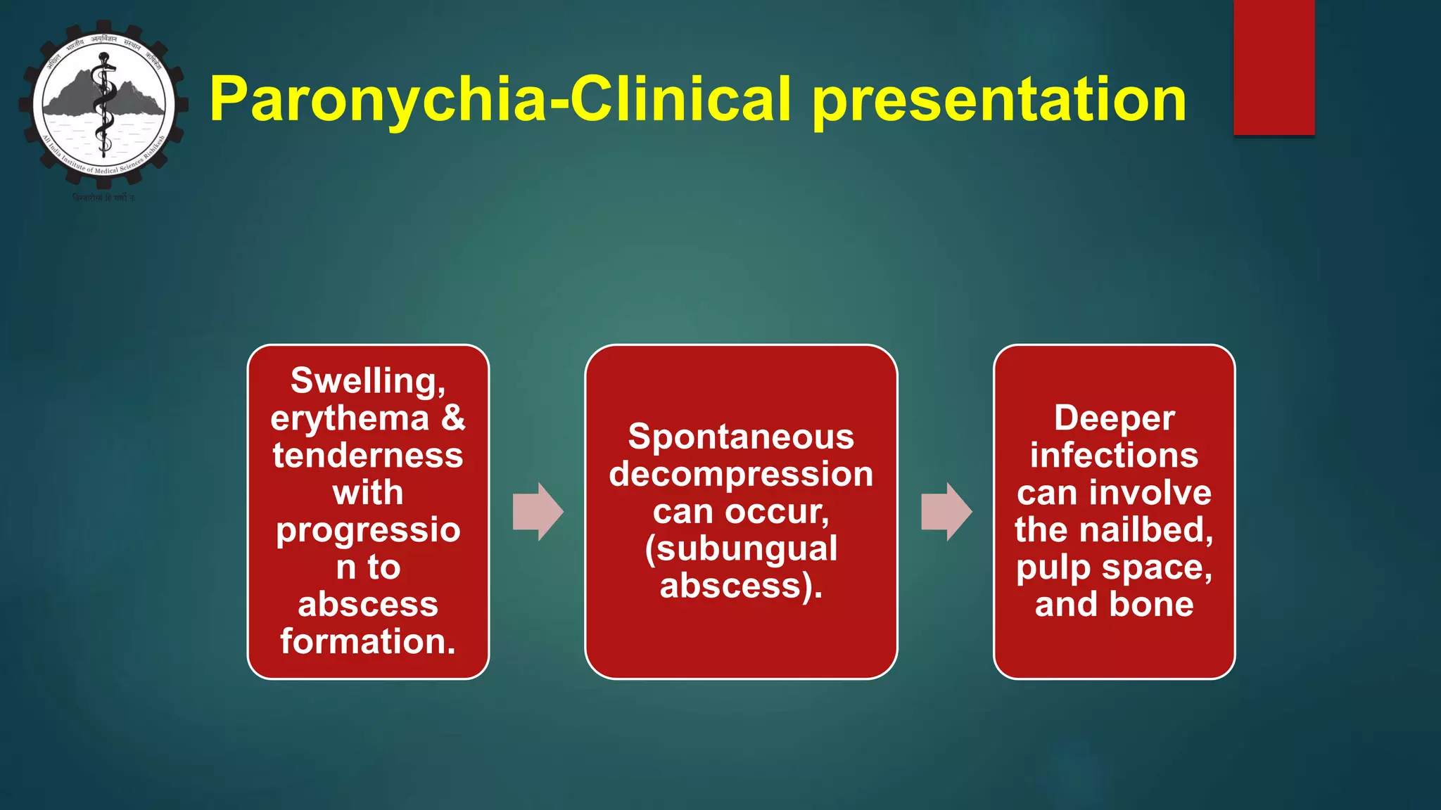 Hand infections | PPTX