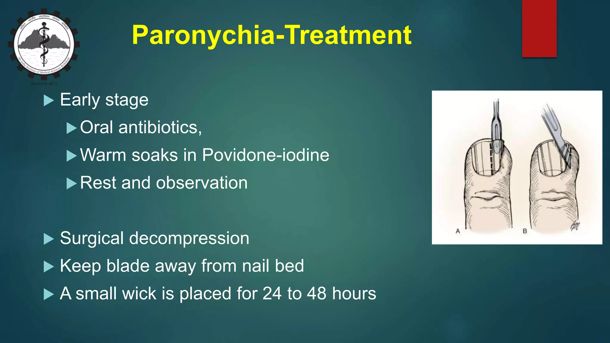 Hand infections | PPTX