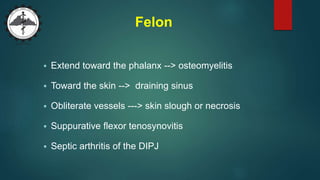 Hand infections | PPTX