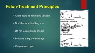Hand infections | PPTX