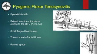 Hand infections | PPTX