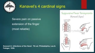 Hand infections | PPTX