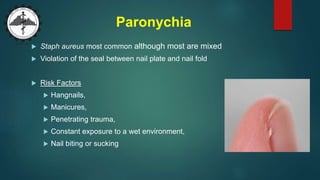 Hand infections | PPTX