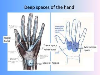 Hand injuries by Dr.SUNIL C | PPTX