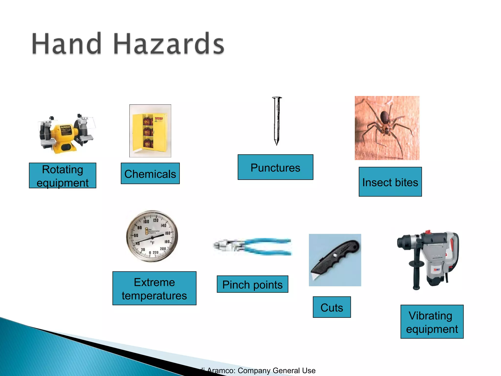Hand injuries | PPS | First Aid | Injuries