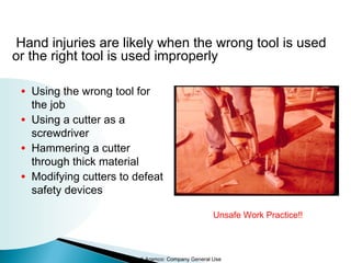 Hand injuries | PPS | First Aid | Injuries