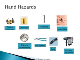 Hand injuries | PPS