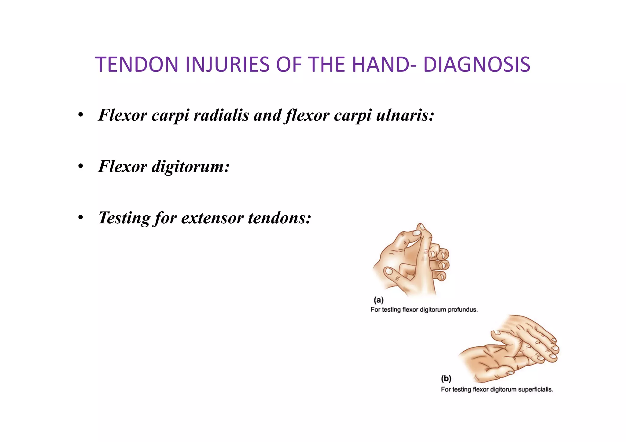 Hand injuries (compiled by Dr. Sanjib Kumar Das) | PDF