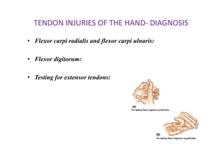 Hand injuries (compiled by Dr. Sanjib Kumar Das) | PDF