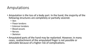 HAND INJURIES.pdf