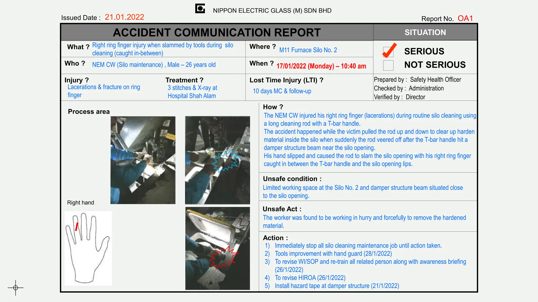 HAND INJURIES in manufacturing company ES | PPTX | First Aid | Injuries