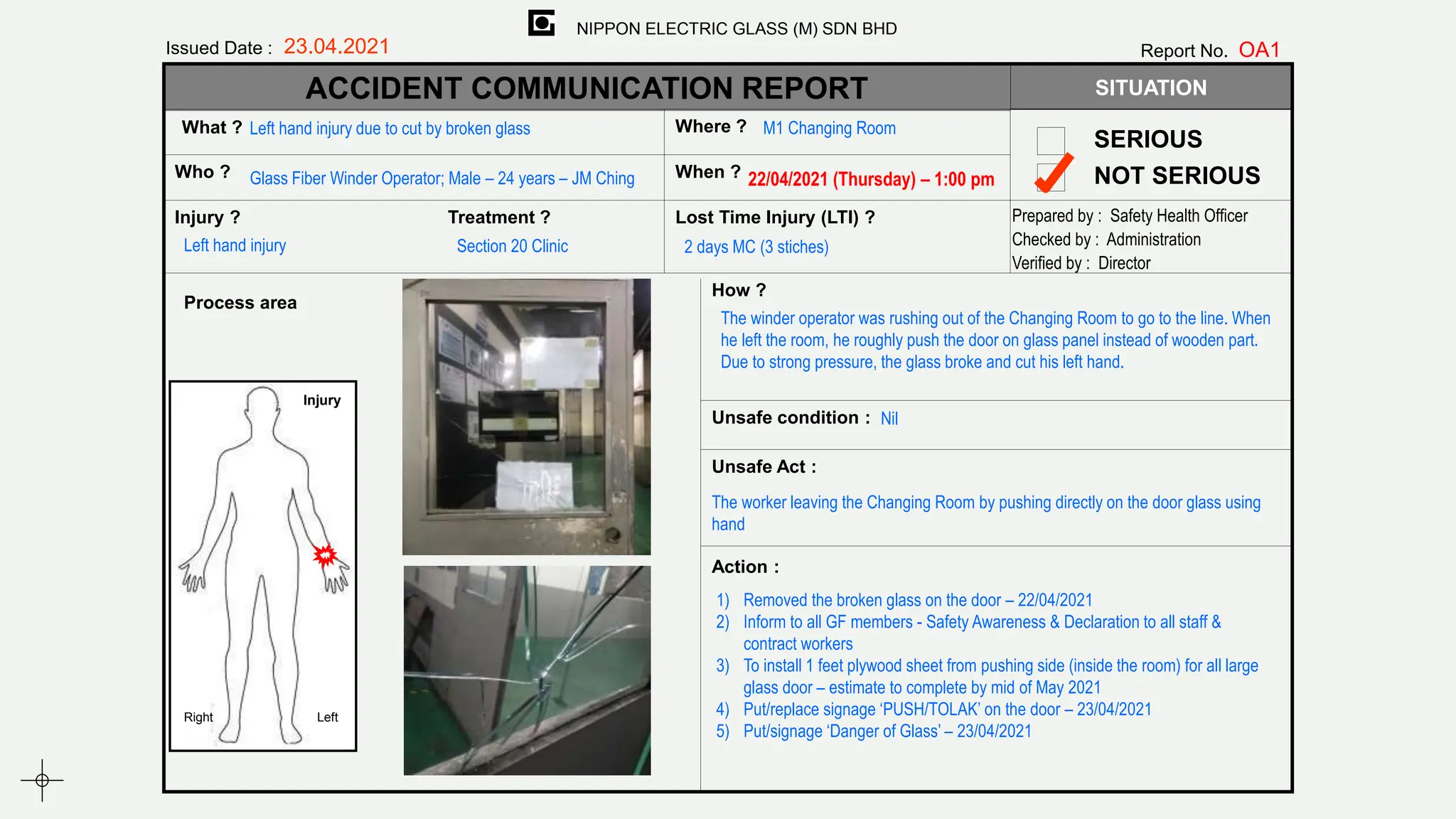HAND INJURIES in manufacturing company ES | PPTX | First Aid | Injuries