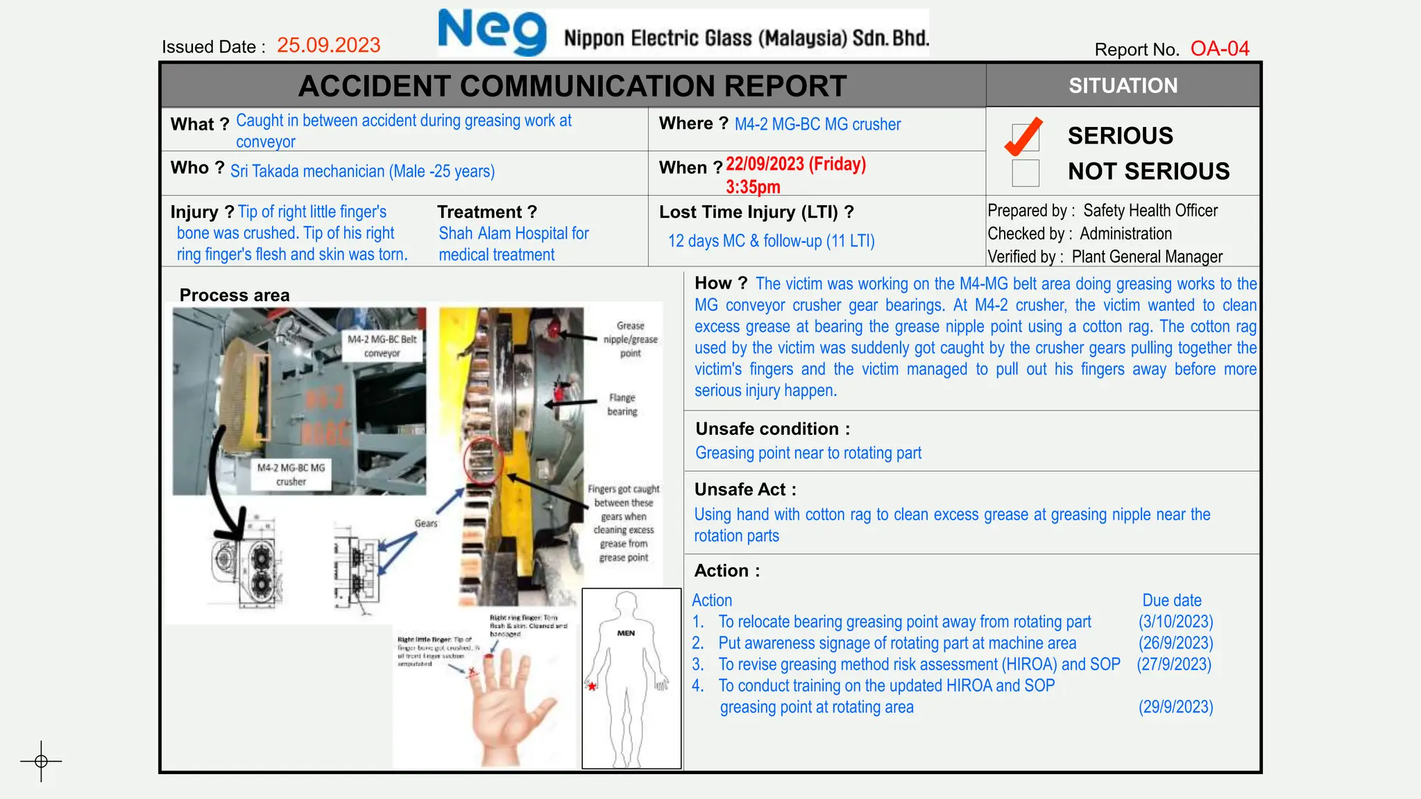 HAND INJURIES in manufacturing company ES | PPTX | First Aid | Injuries