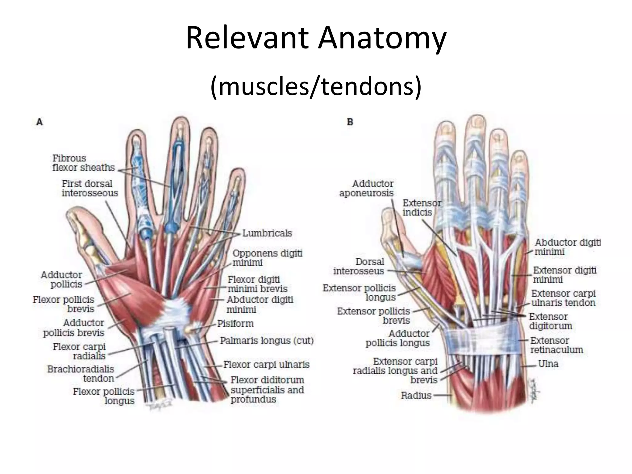 Hand Injuries Overview- Surgery | PPT