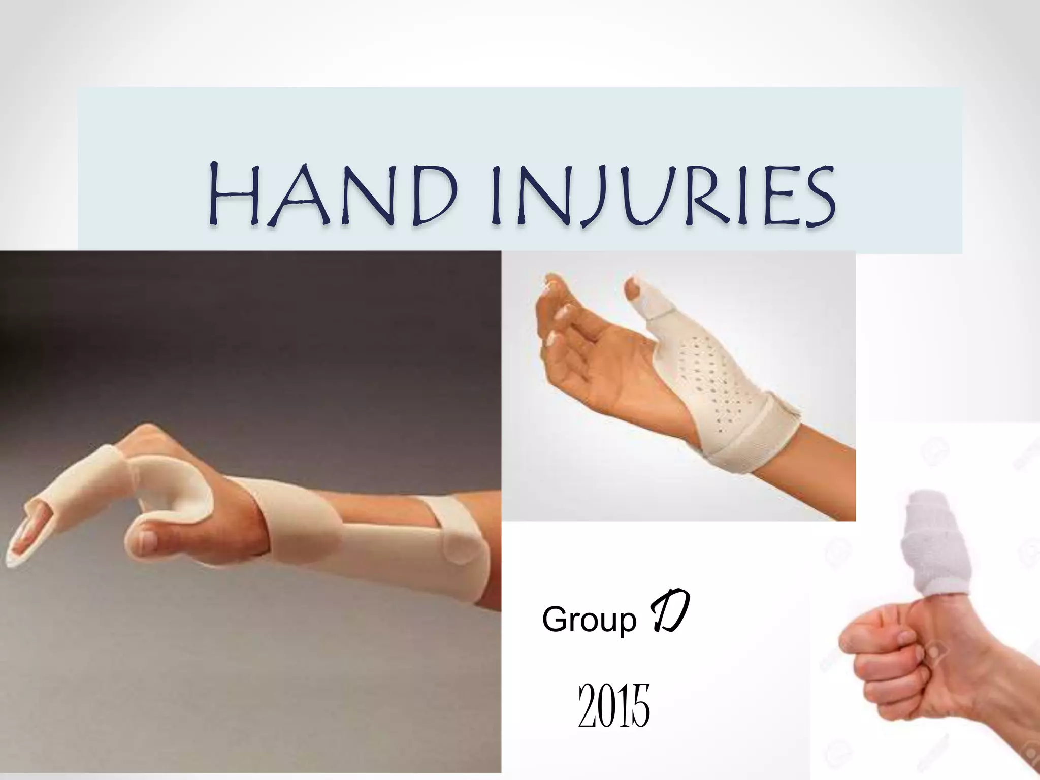 Hand injuries | PPTX
