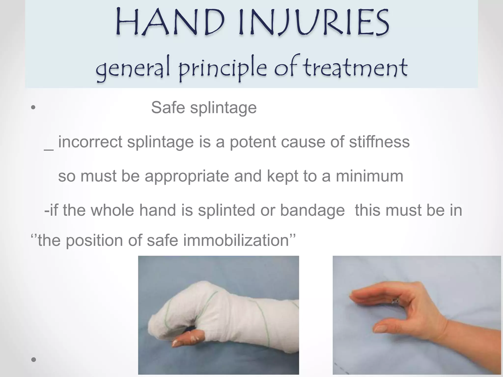 Hand injuries | PPTX