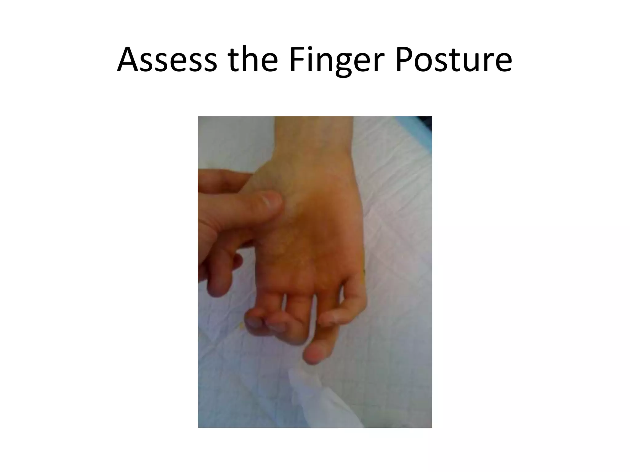 hand_injuries_PPT.ppt