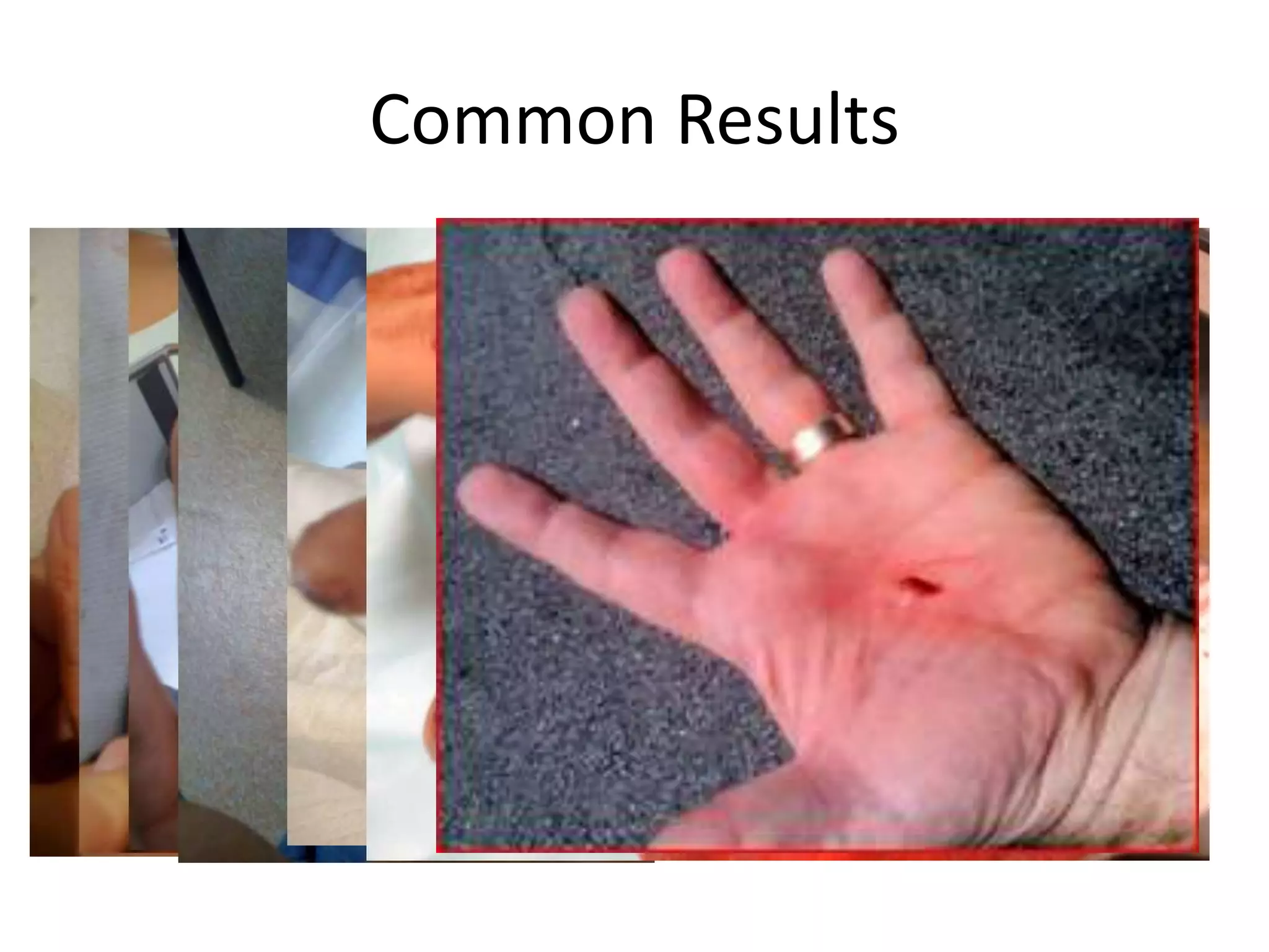 hand_injuries_PPT.ppt