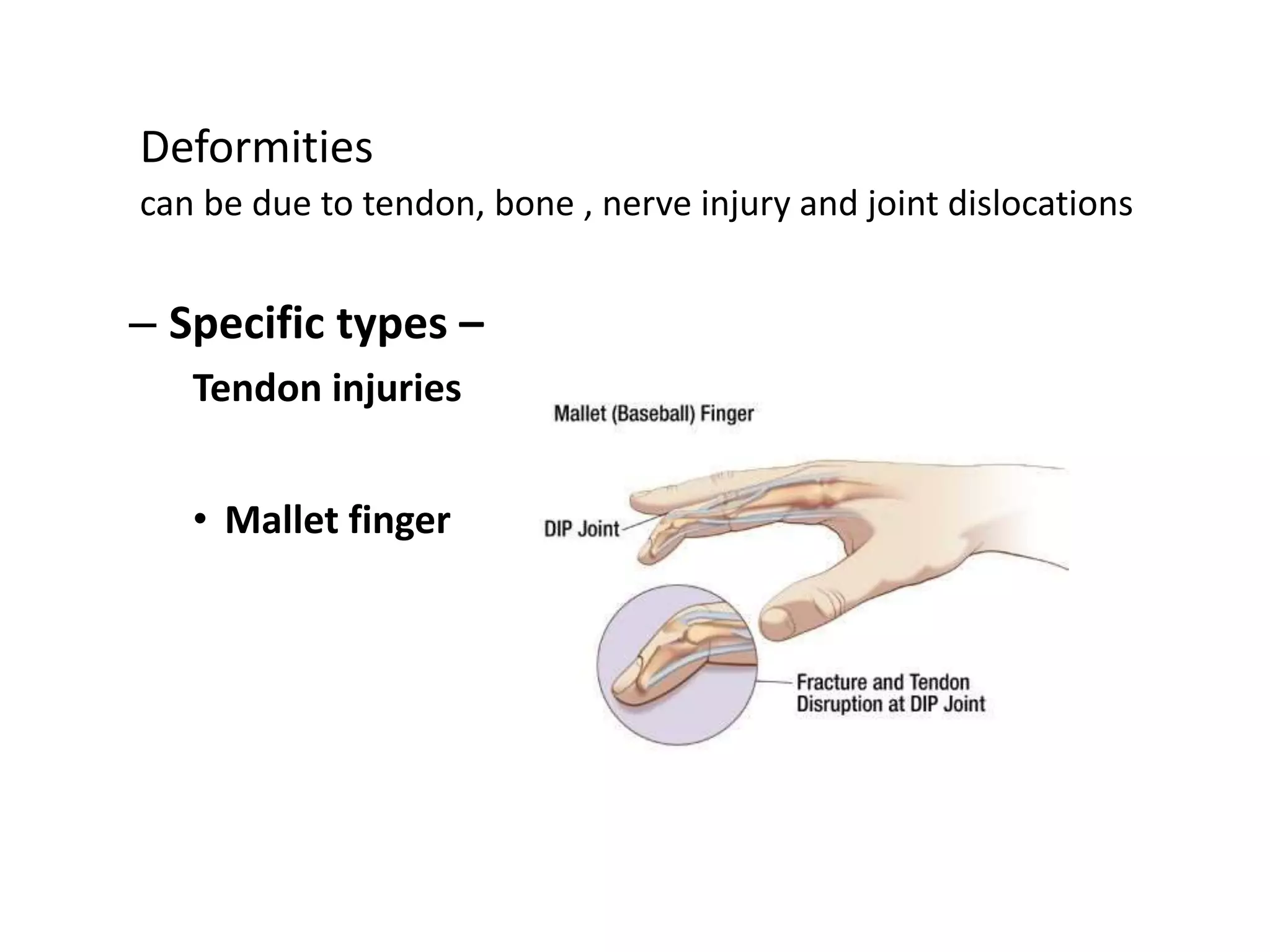 hand_injuries_PPT.ppt