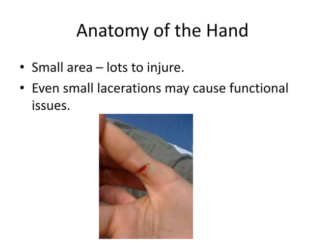 hand_injuries_PPT.ppt
