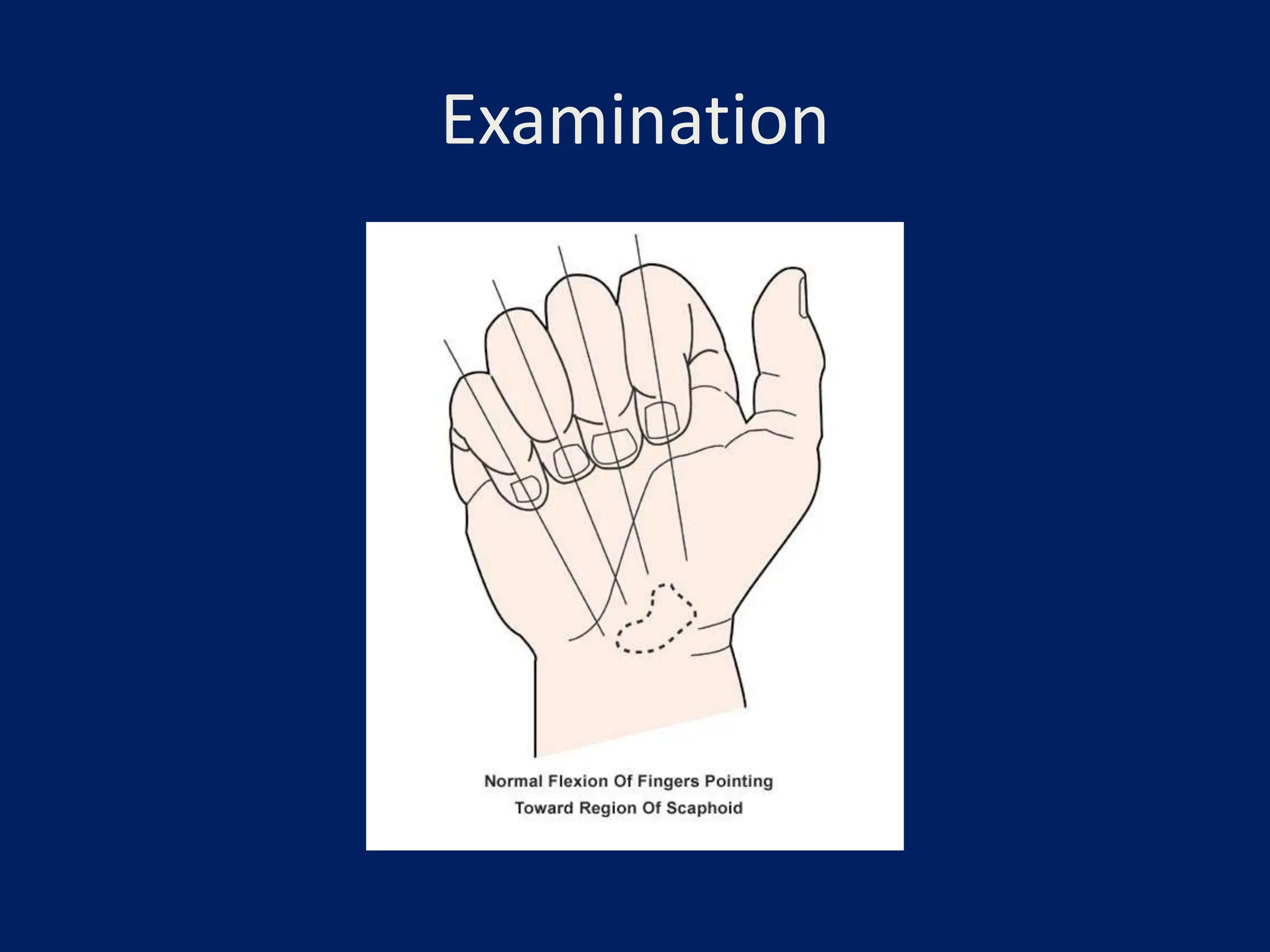 hand injury presentation to be use in safety comaign | PPT