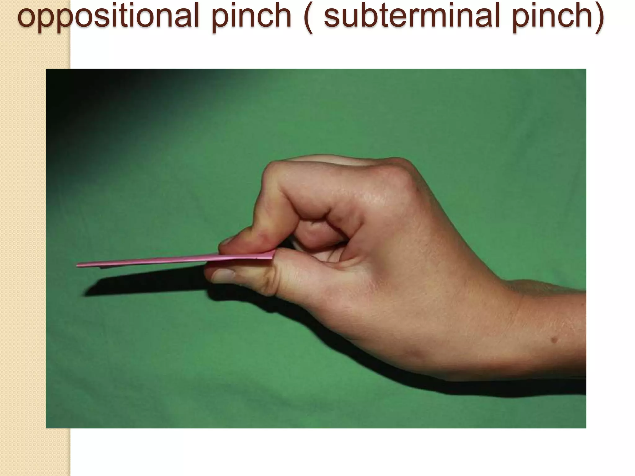 Hand Injuries & Their Managements | PPTX