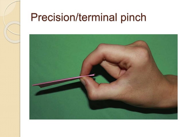 Hand Injuries & Their Managements | PPTX