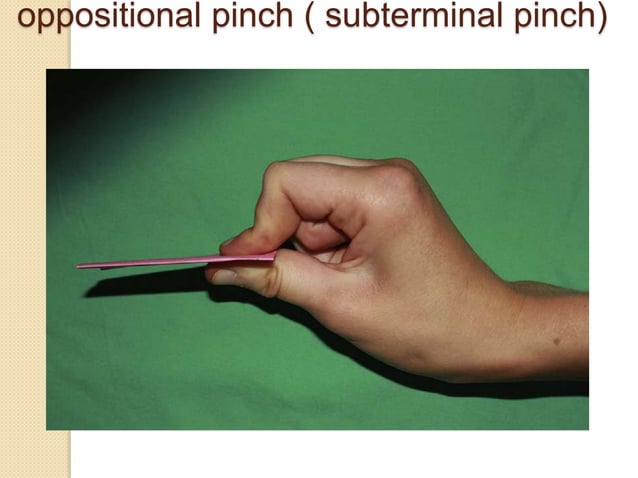 Hand Injuries & Their Managements | PPTX