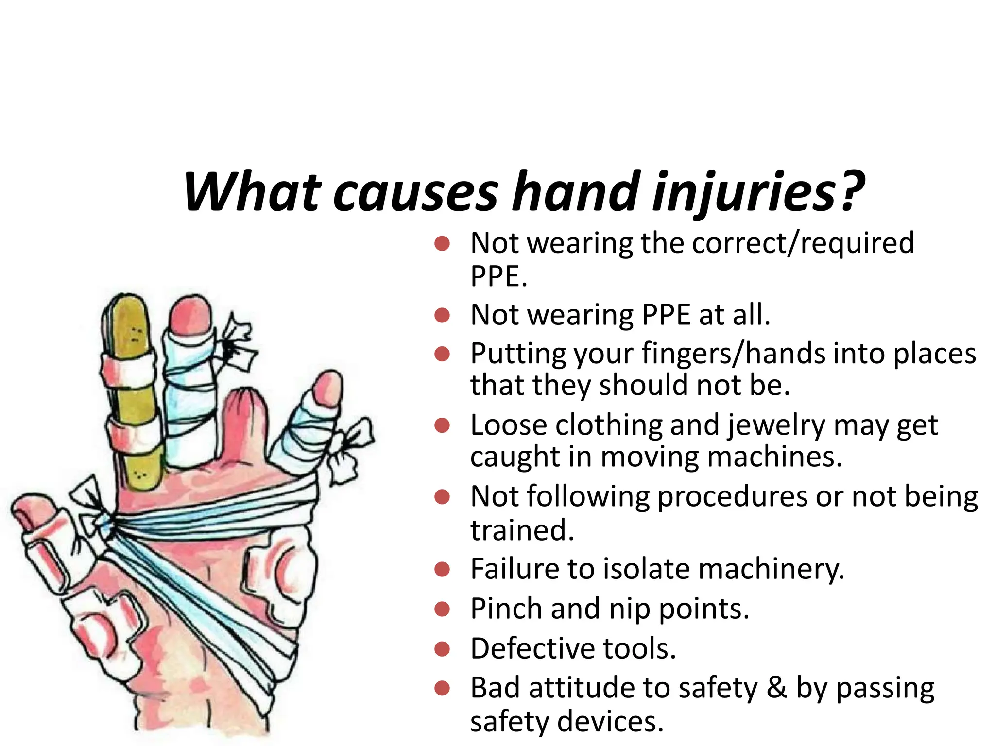 Health and safety hand injury trainning.docx