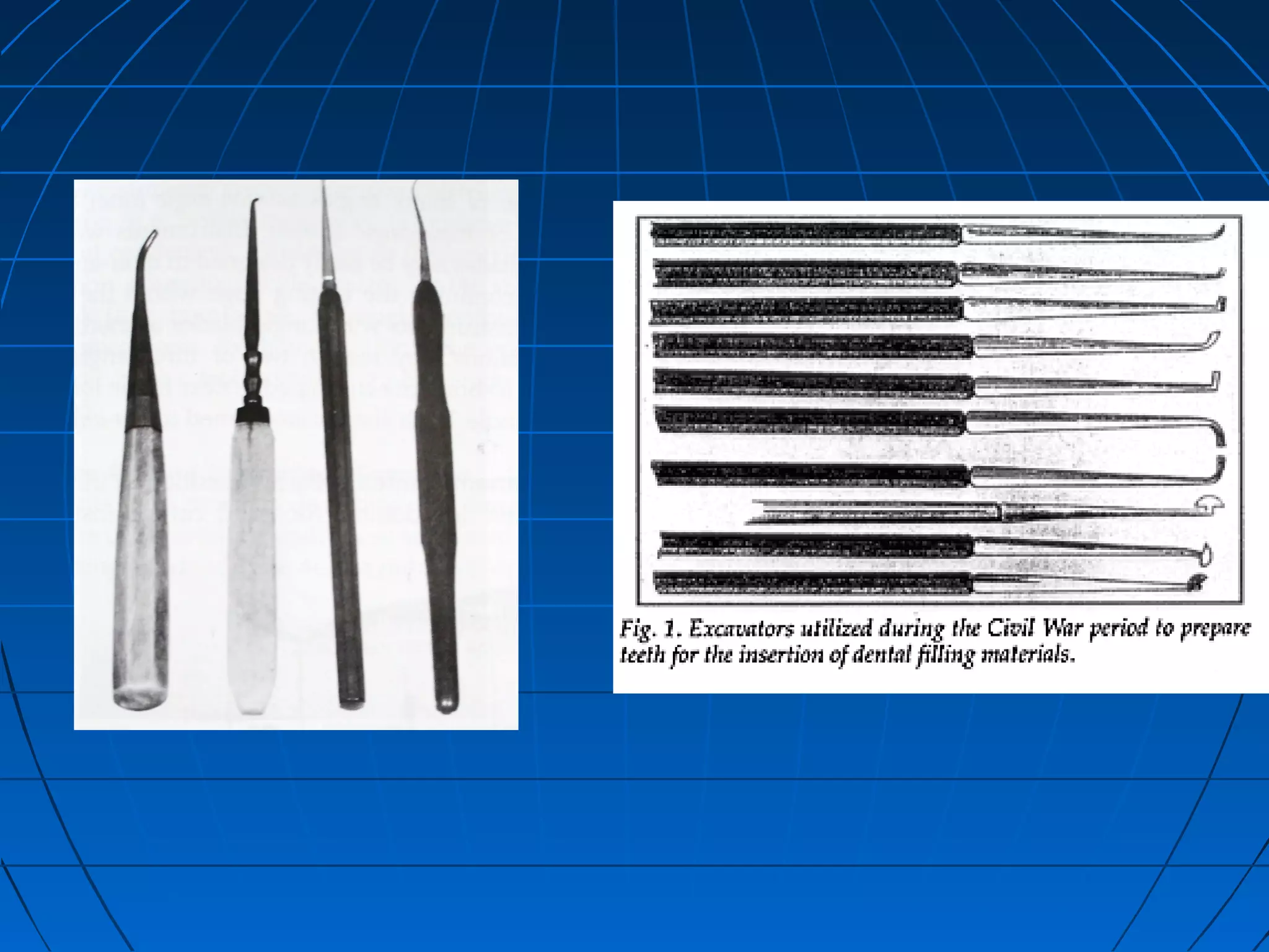 Hand instruments and instrumentation | PPT