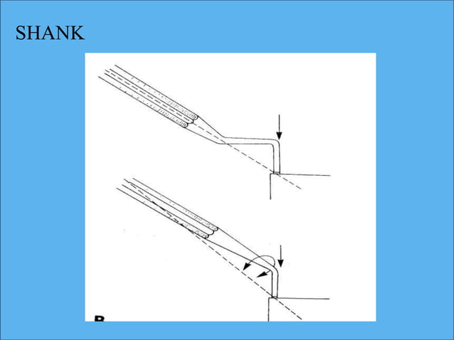 Hand instruments in operative dentistry | PPT
