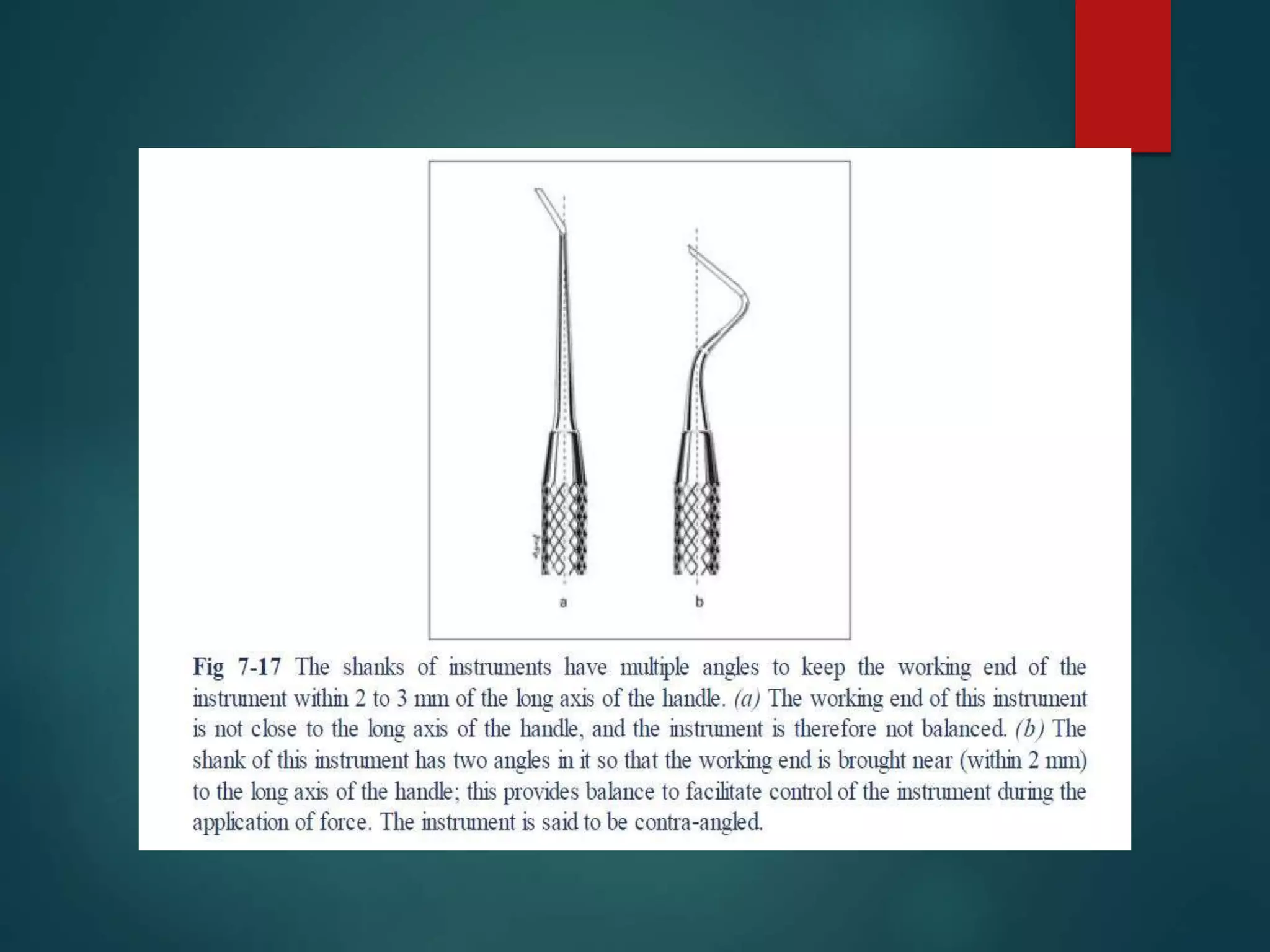 Hand instruments in operative dentistry 2 nd yr | PPTX