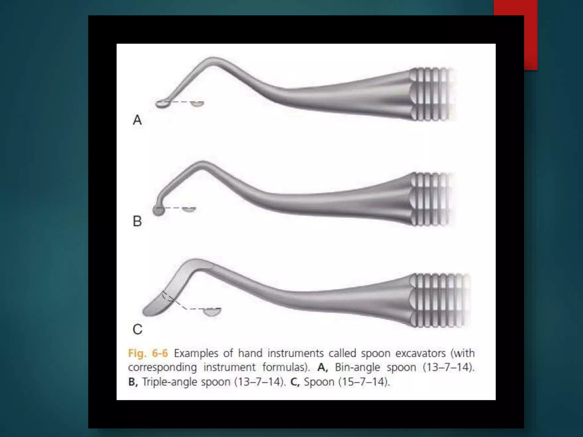 Hand instruments in operative dentistry 2 nd yr | PPTX