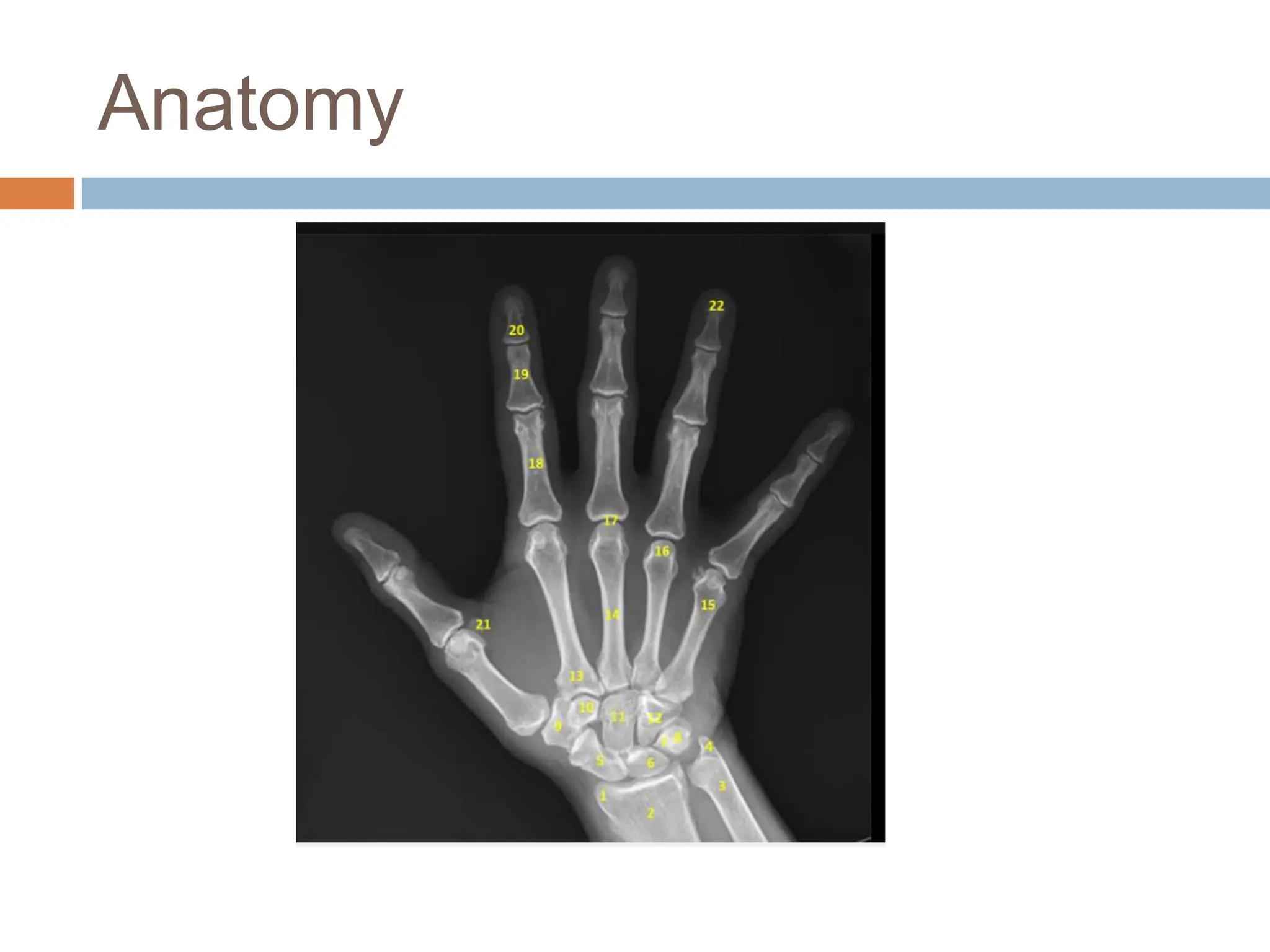 radiology of hand in systemic diseases ppt | PPTX