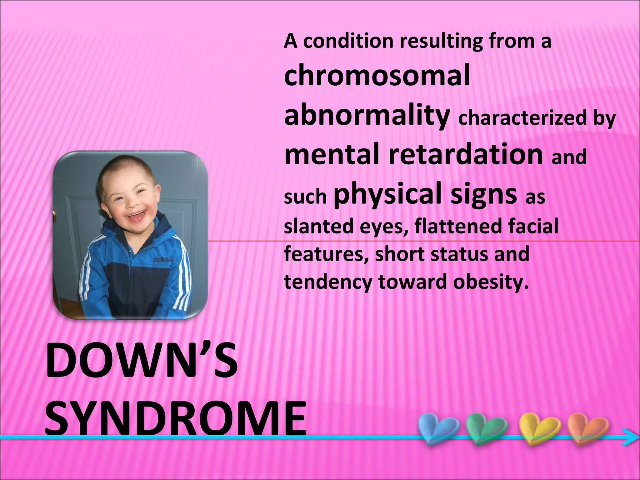 Handling Children with Special Needs | PPT