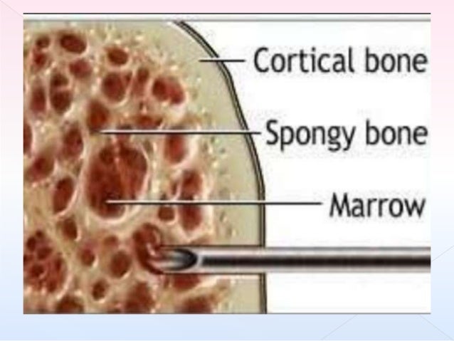 processing of bone marrow trephine biopsy