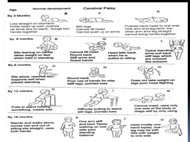 Handling of children with cerebral palsy PPT-vinay (1) (1).pdf