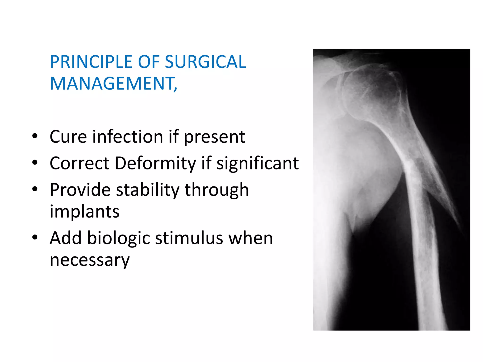 INFECTED FRACTURES, INFIRM PATIENT, INDOMITABLE SURGEON HANDLING NON ...