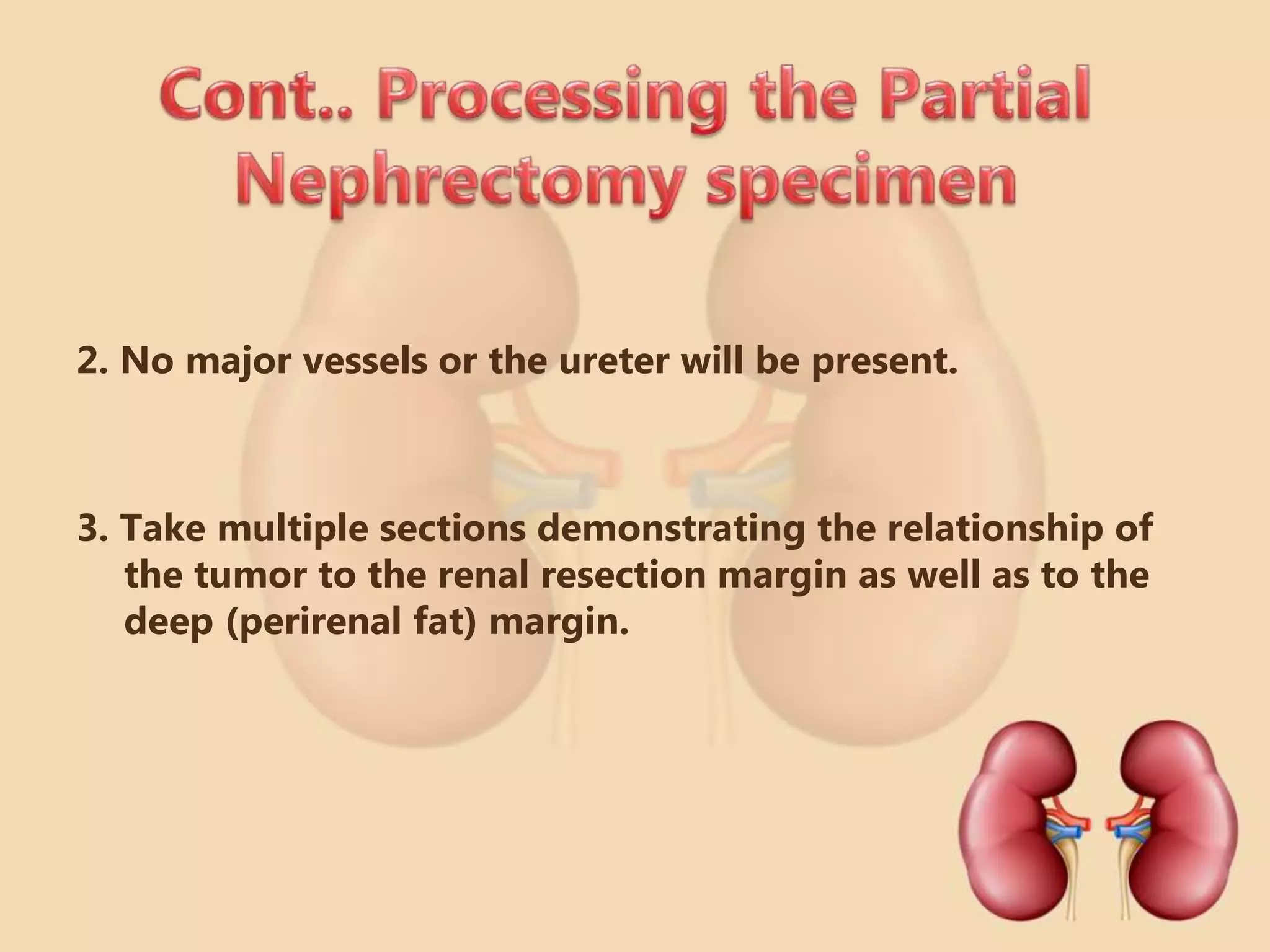 Handling of kidney specimen | PPTX