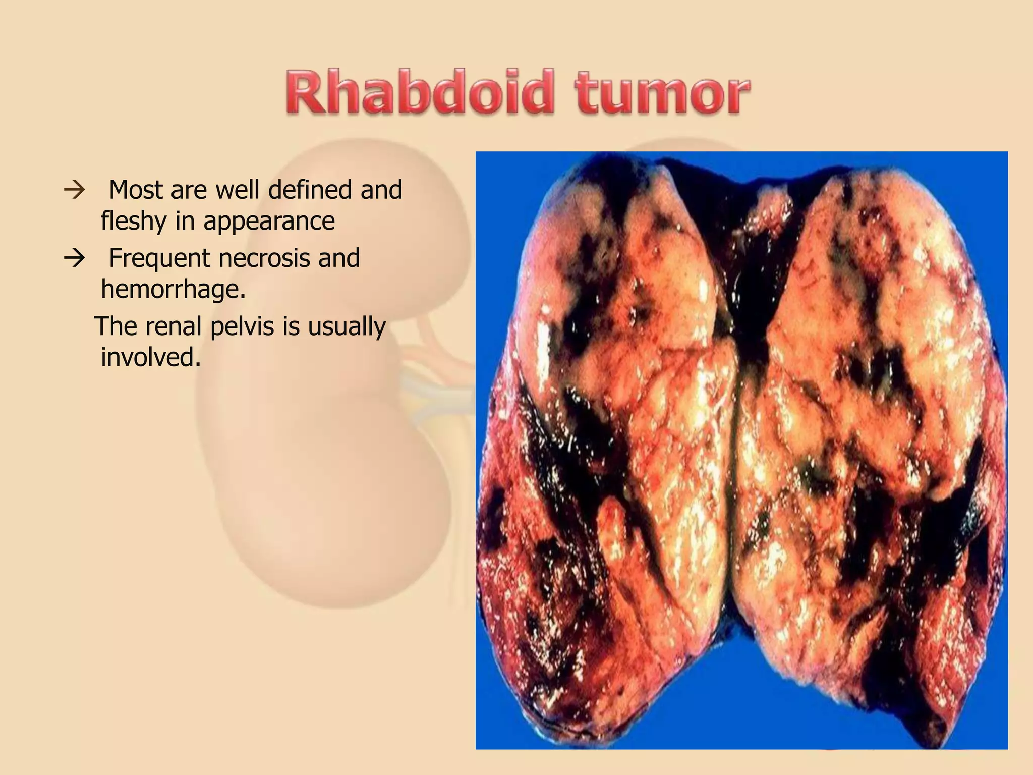 Handling of kidney specimen | PPTX