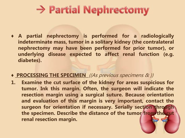 Handling of kidney specimen | PPTX | Surgery | Medical Health