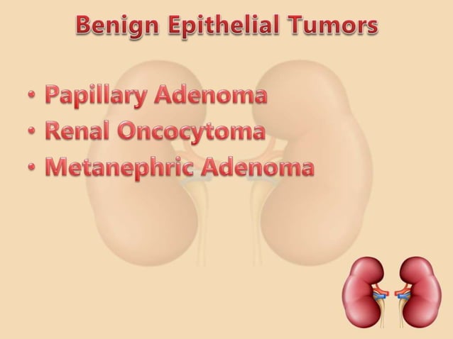 Handling of kidney specimen | PPTX | Surgery | Medical Health